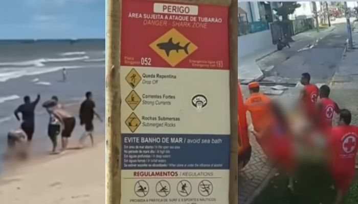VÍDEO: Menino de 11 anos tem perna amputada após ataque de tubarão